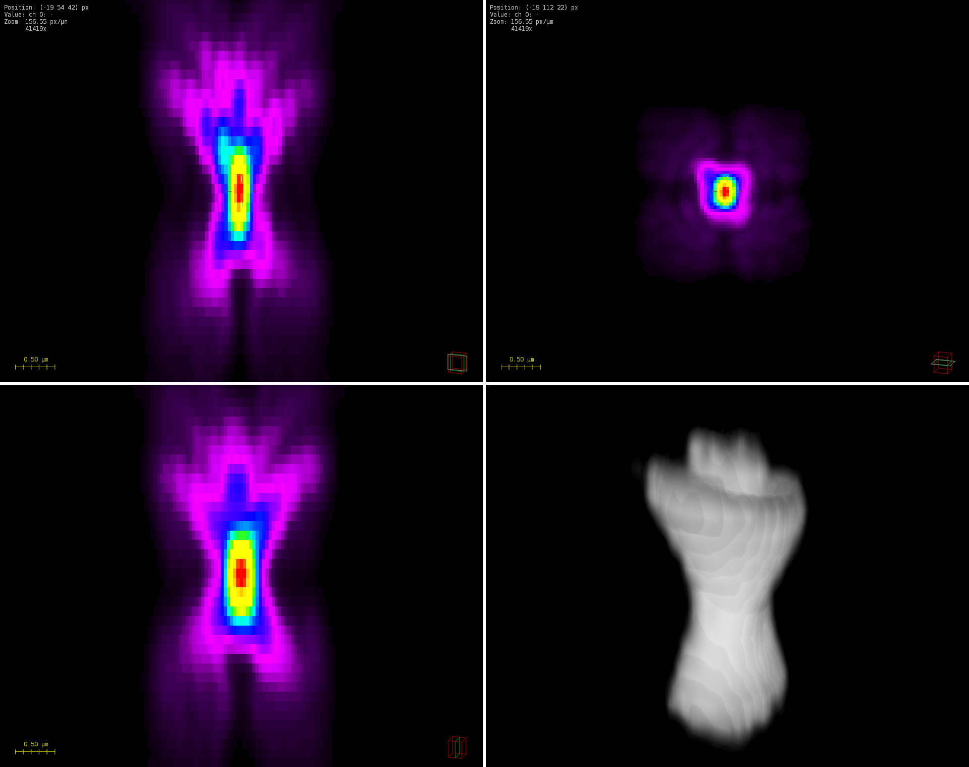 Why do you do PSF? How often do you do PSF? Three microscope experts ...